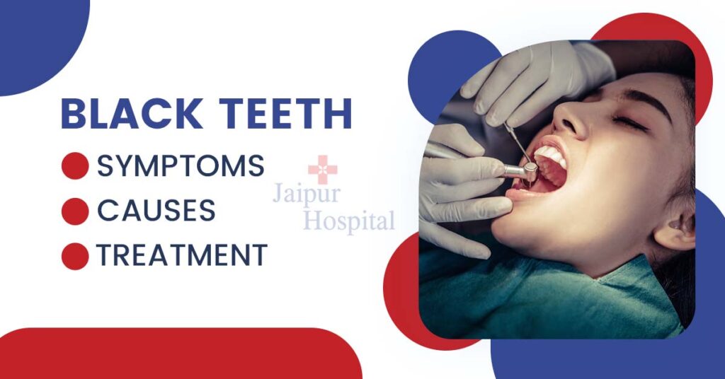 Black Teeth: Causes, Symptoms, and Treatment - Jaipur Hospital
