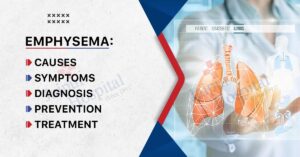 Emphysema: Causes, Symptoms, Diagnosis, Prevention & Treatment