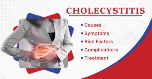 Cholecystitis: Causes, Symptoms, Risk Factors, Complications and Treatment