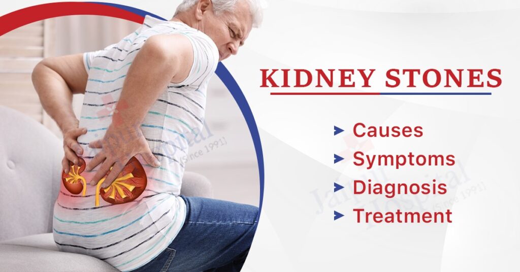 Kidney Stones: Causes, Symptoms, Diagnosis & Treatment