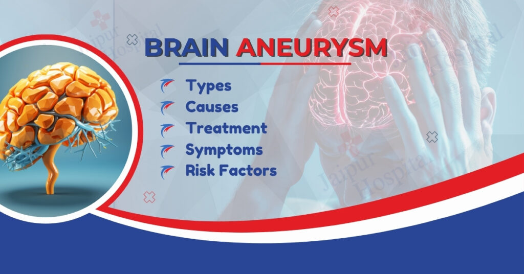 Brain Aneurysm: Types, Symptoms, Causes, Treatment