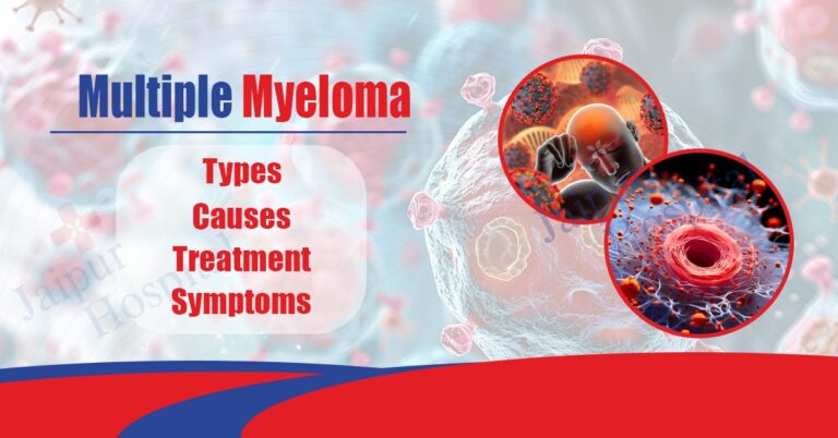 Multiple Myeloma: Types, Causes, Symptoms, and Treatments