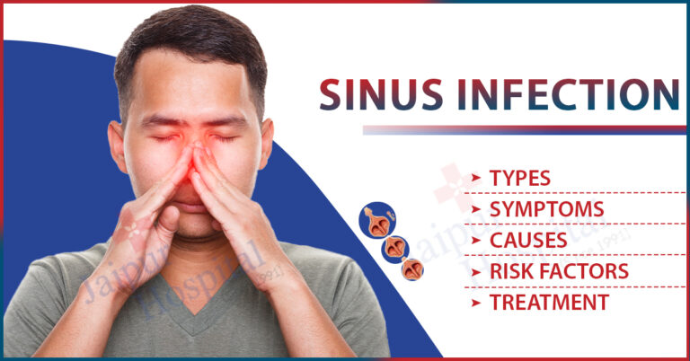 Sinus Infection: Types, Symptoms, Causes, Risk Factors