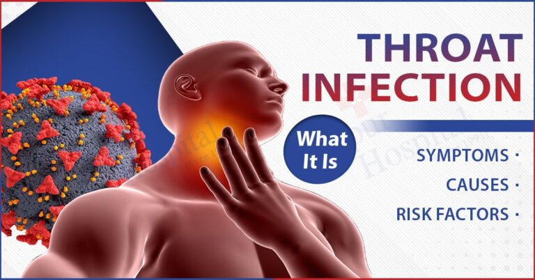 Throat Infection: What Its, Symptoms, Causes, and Risk Factors - Jaipur ...