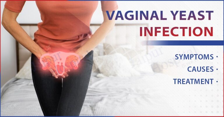 Vaginal Yeast Infection | Causes Symptoms and Treatment