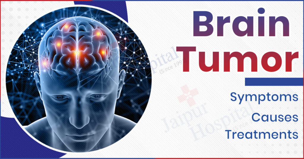 Brain Tumor: Symptoms, Causes & Treatments - Jaipur hospital